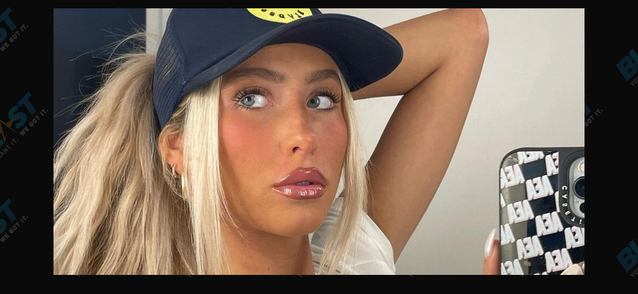 TikToker Alix Earle Shares Struggles With Acne and Using Filters