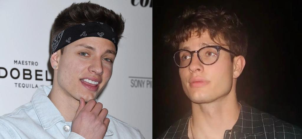 Matt Rife Reveals Real Reason Behind His Dramatic Facial Transformation