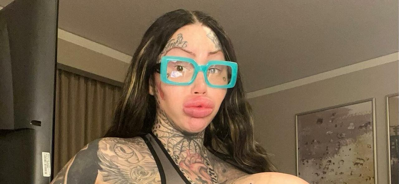 Model’s 38J Breast Implant Explodes, Becomes The ‘Uniboob Queen’