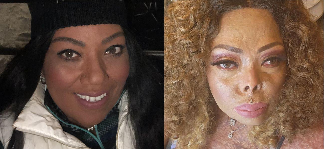 Popular Beauty Influencer Recalls Surviving Being Set On Fire By Her Ex