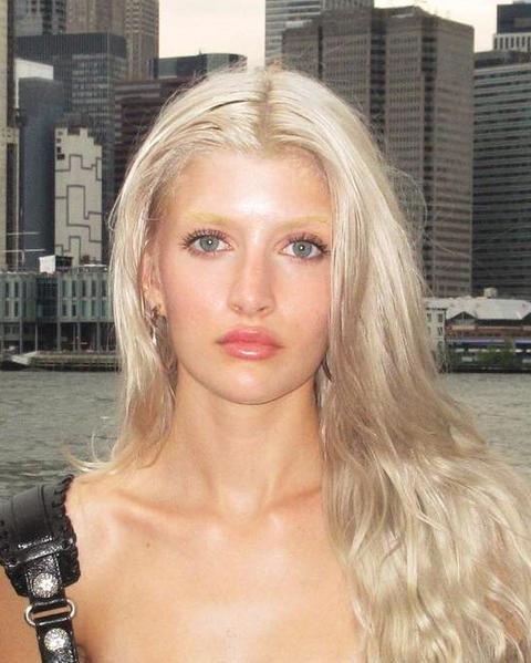 Sami Sheen Says Getting Breast Augmentation Surgery Will Save Her Life