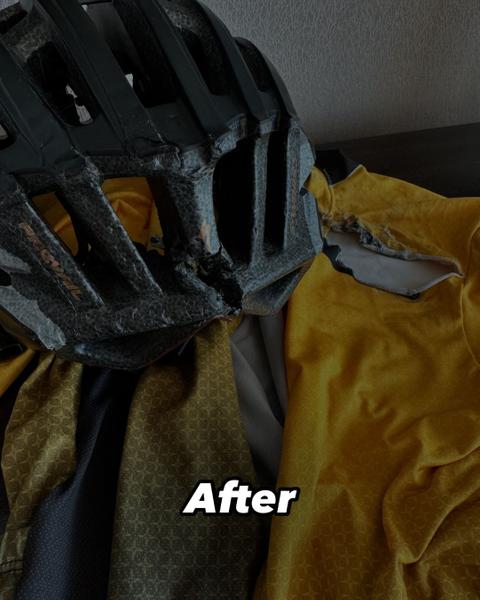 Gordon Ramsay Gets Badly Bruised After Major Bike Accident