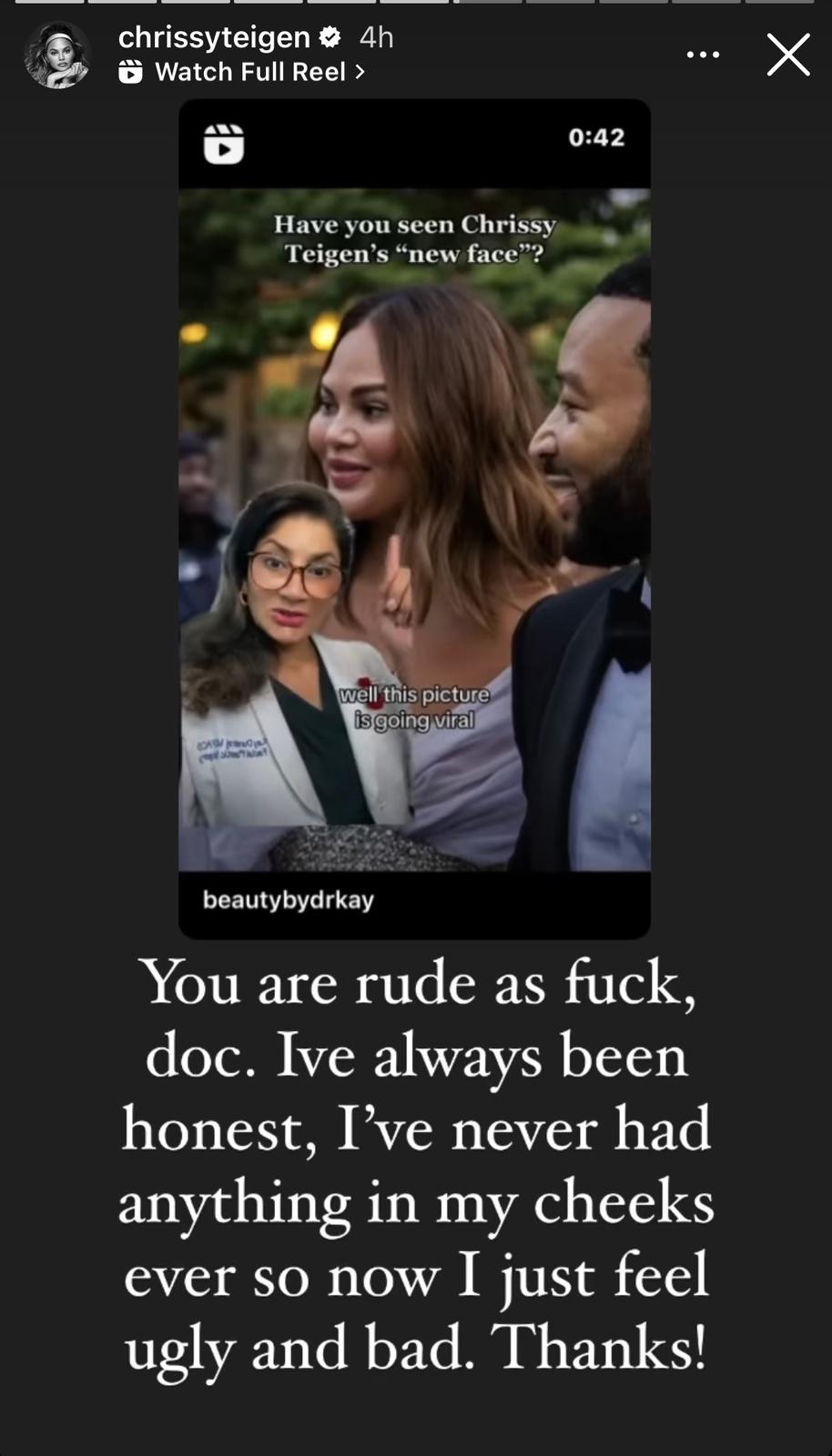 Chrissy Teigen Slams Plastic Surgeon Who Says She Had Botched Procedure