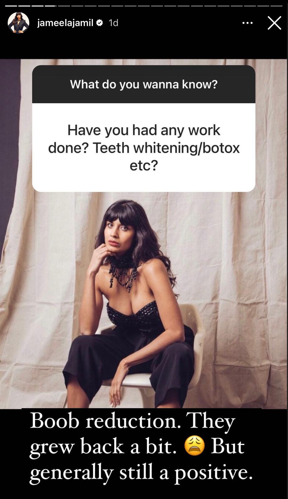Jameela Jamil Reveals The Only Enhancement Surgery She Had