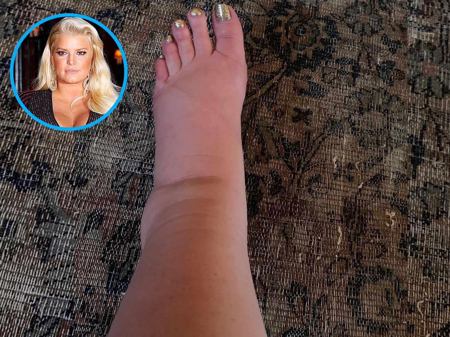Pregnant Jessica Simpson Needs Help for Her Gnarly Swollen Feet - The Blast