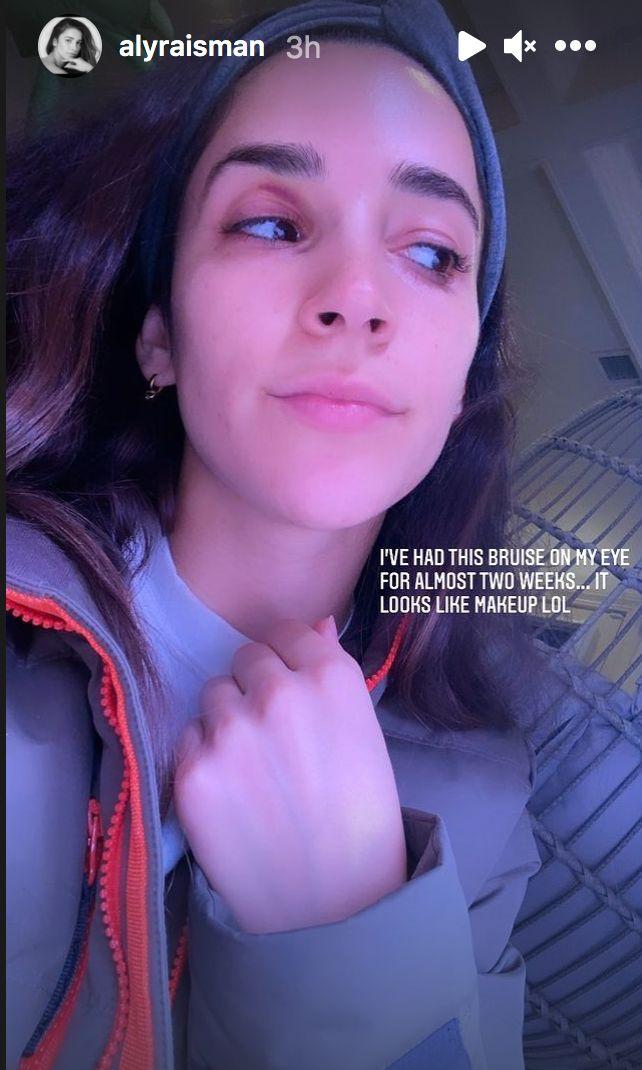 Gymnast Aly Raisman Flawless Without Makeup For Wellness Check In - The ...