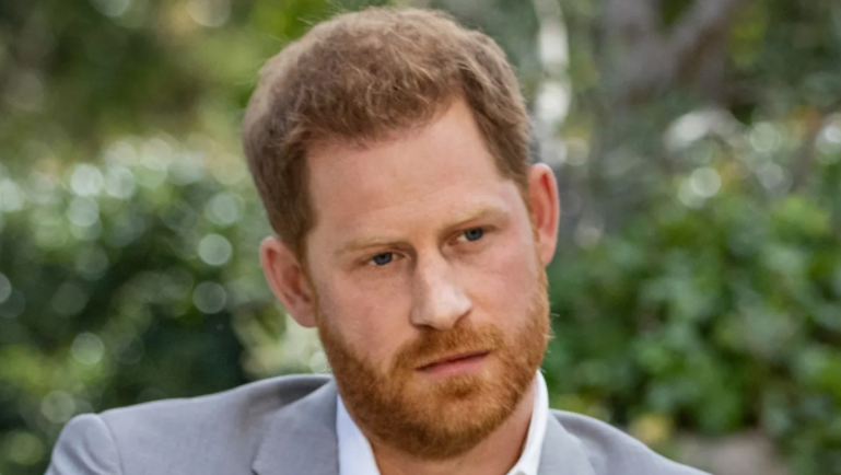 Prince Harry's Thinning Hairline, Expert Speaks Out - The Blast