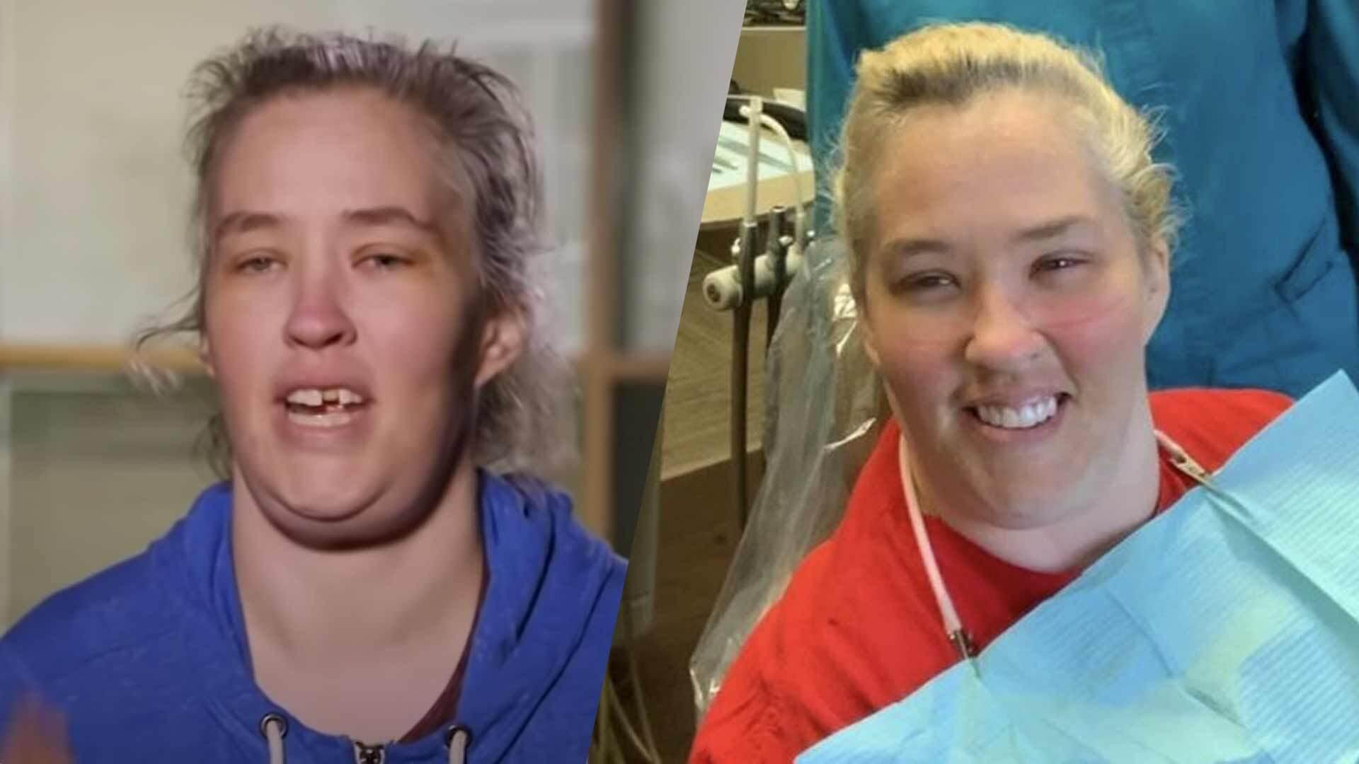 Mama June Gets Her Teeth Fixed, Looks Like A New Woman - The Blast